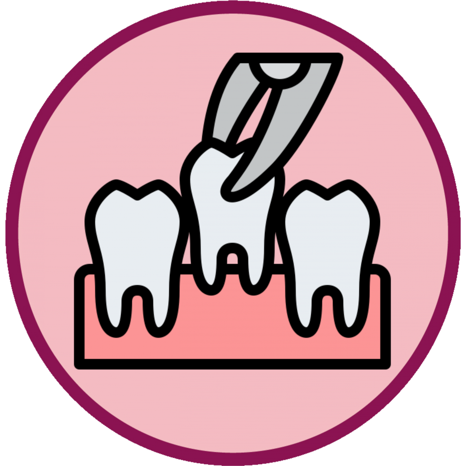 ถอนฟัน - Clover Smile Dental Clinic