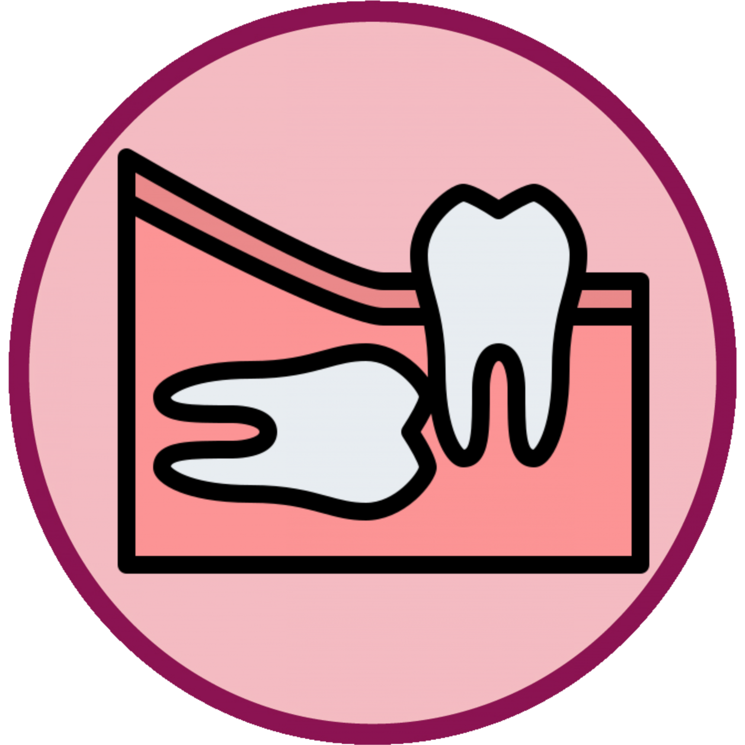ผ่าฟันคุด - Clover Smile Dental Clinic